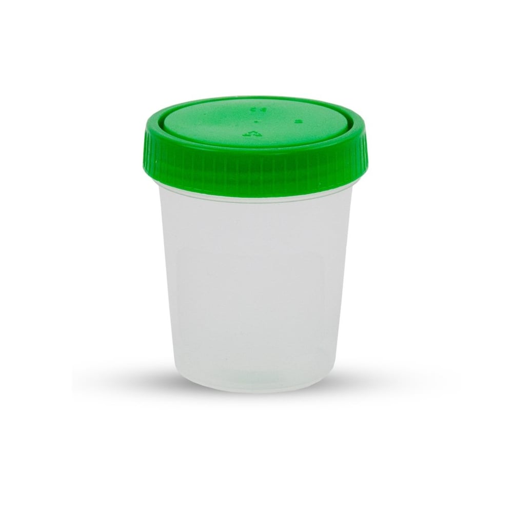 Urine jar with screw cap | Laboratory equipment | 24h Delivery ...