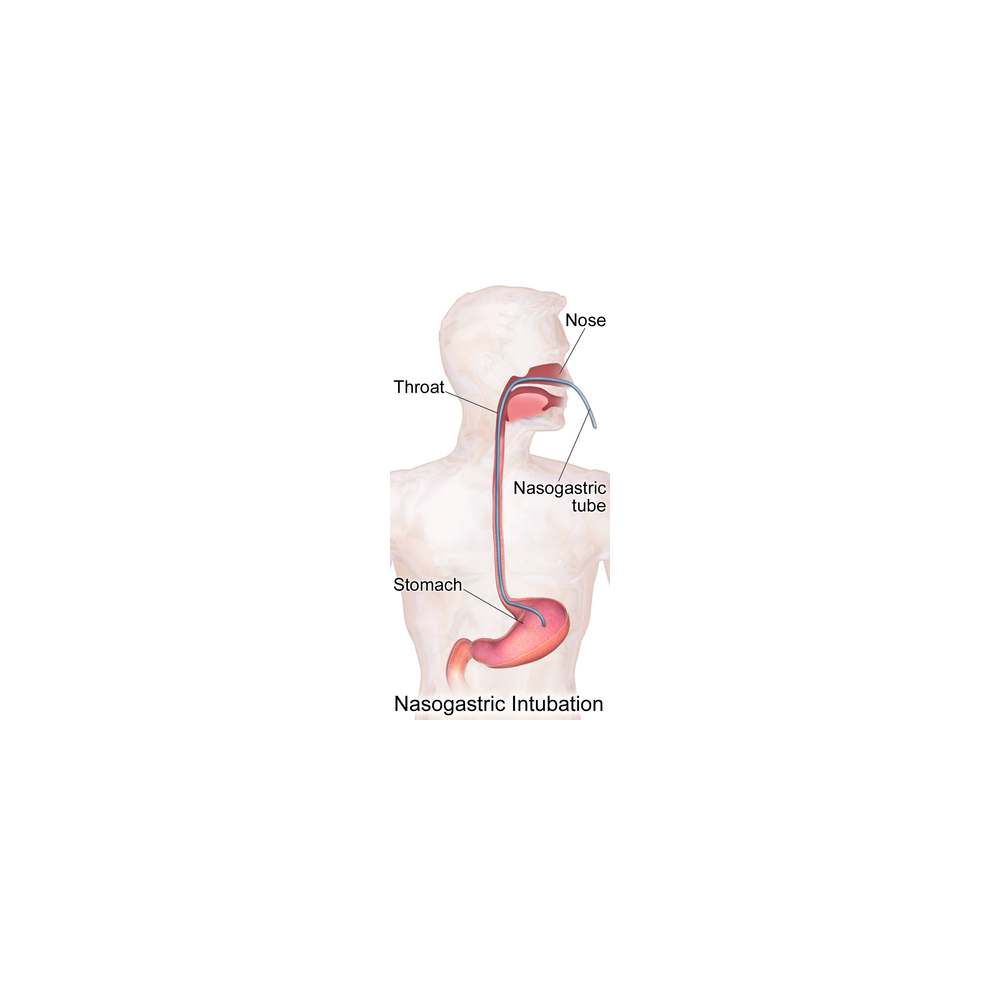 Duodenal probe Levin for gastroscopic use - HerliMedical.com